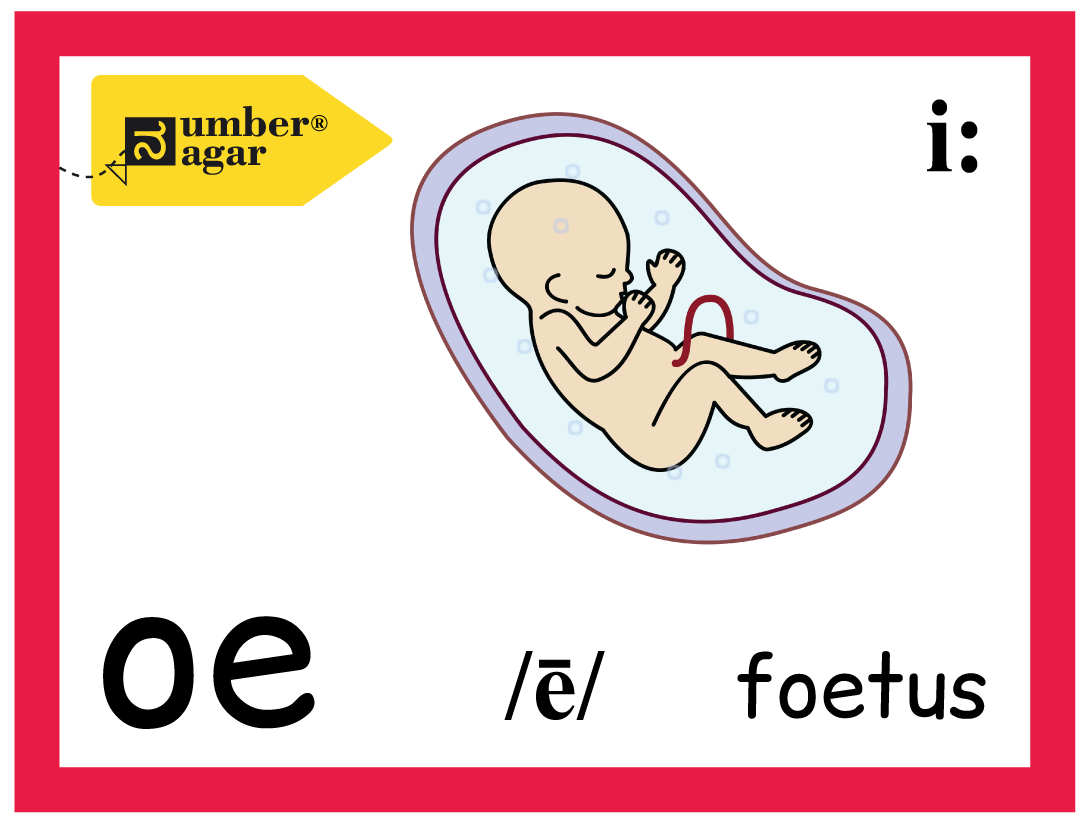 The many sounds of ‘oe’ - Blog it with Kudums™